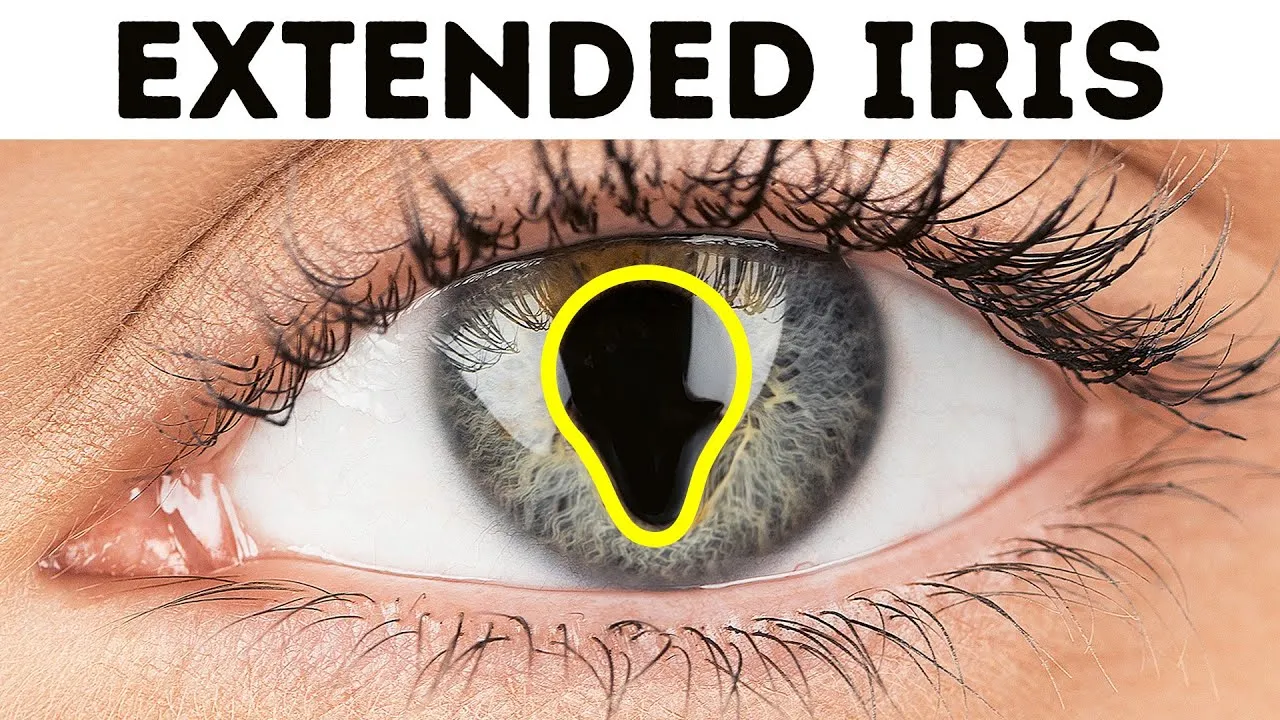 20+ Rarest Body Features You May Have and Your Friends Not - ClassX