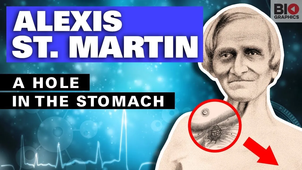 Alexis St Martin: A Hole in the Stomach - ClassX