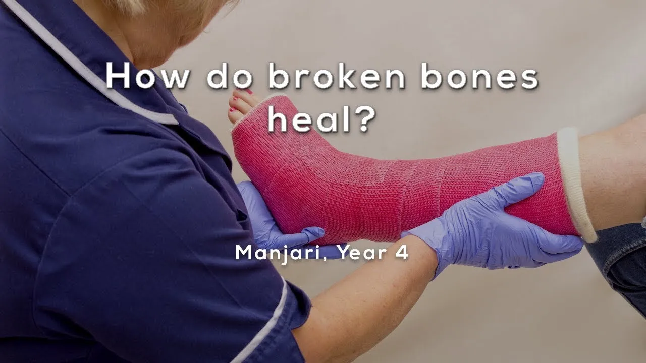 How do broken bones heal? - ClassX