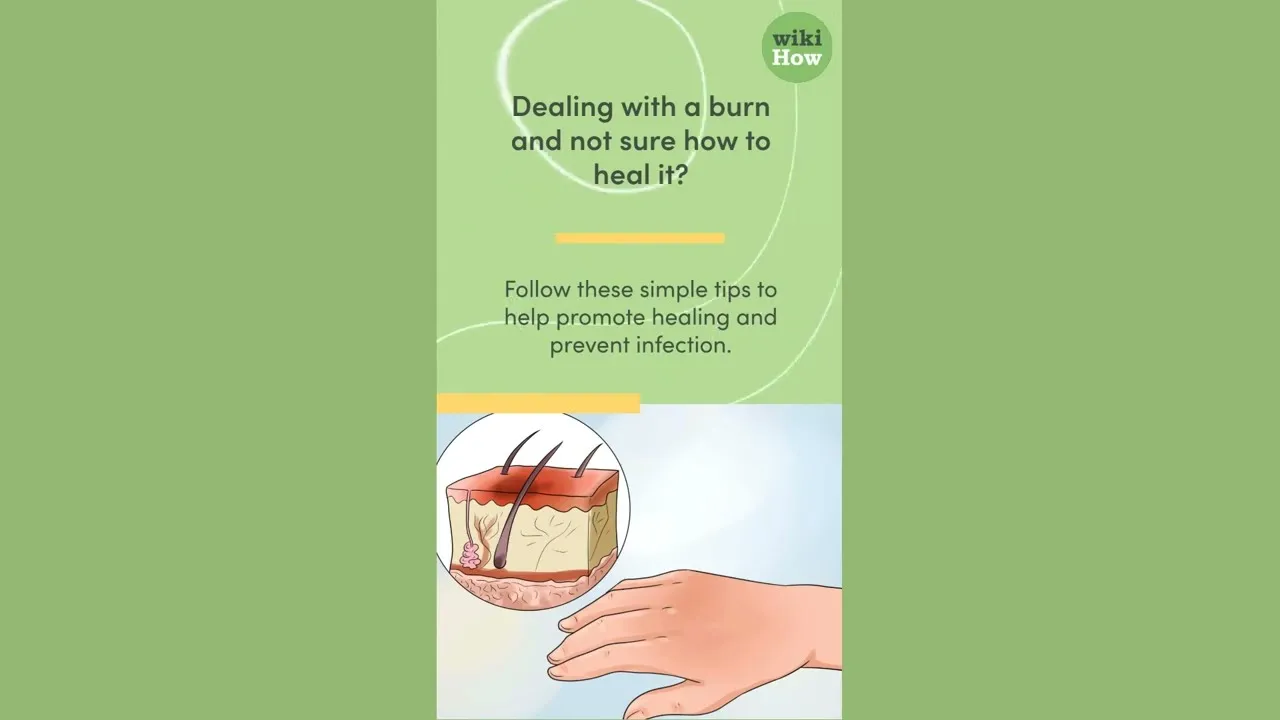How To Heal a Burn - ClassX