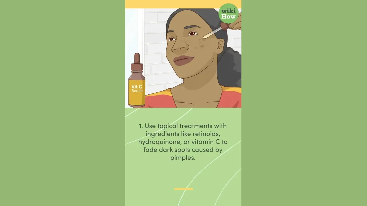How To Remove Dark Spots Caused By Pimples Classx 8395