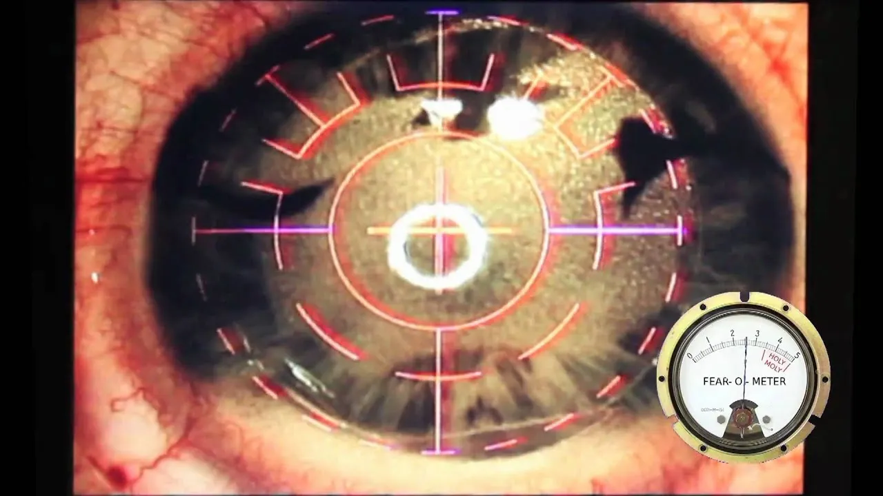 Intralase LASIK Procedure with Fear-o-meter and Pain-o-meter - ClassX