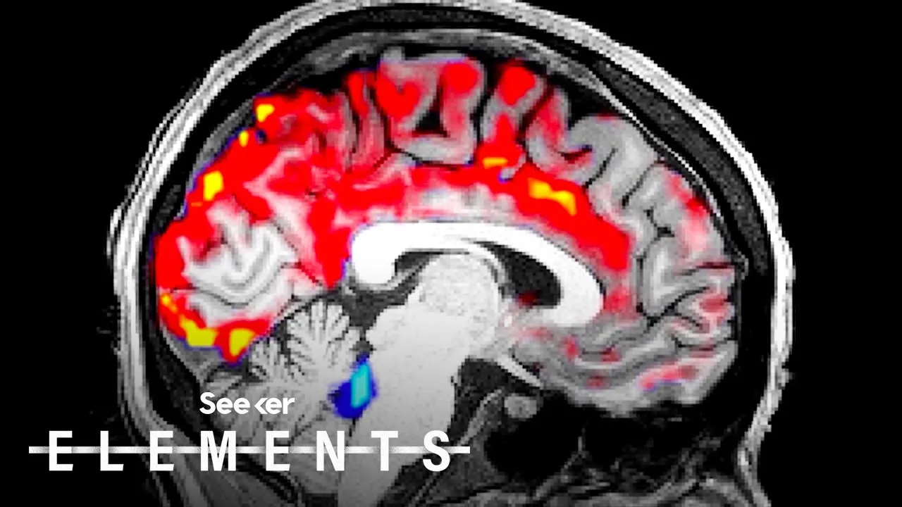 Scientists Discovered How Sleep Cleans Toxins From Your Brain - ClassX